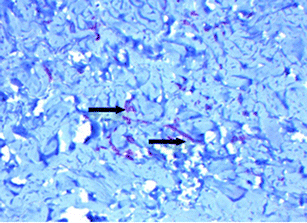 DermACELL: a novel and biocompatible acellular dermal matrix in tissue ...
