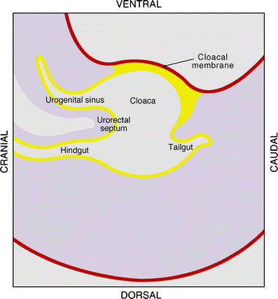 Congenital anomalies of the male urethra | SpringerLink