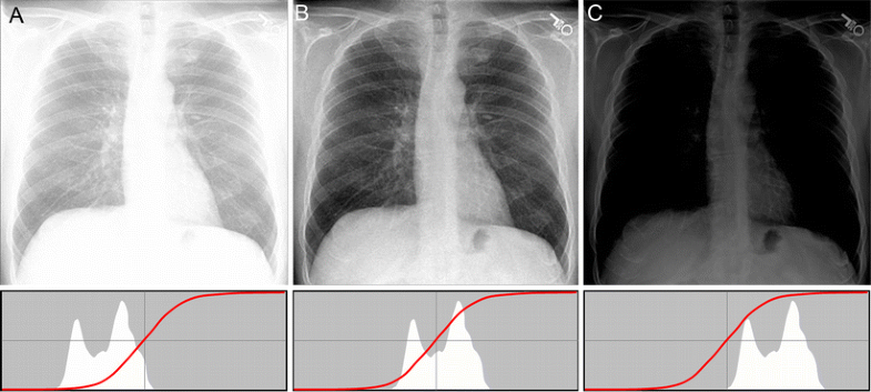 The standardized exposure index for digital radiography: an opportunity ...