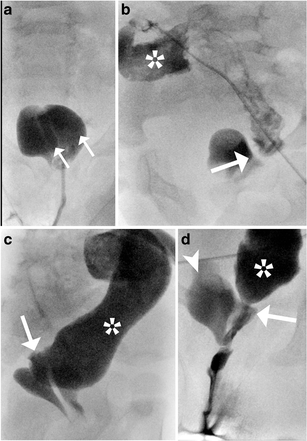 European Society of Paediatric Radiology abdominal imaging task force ...