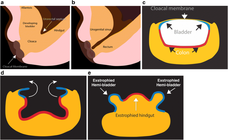 Fetal anterior abdominal wall defects: prenatal imaging by magnetic ...