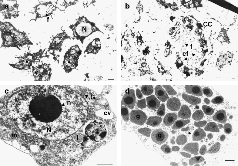 Microbial Diversity of the Freshwater Sponge Spongilla lacustris ...