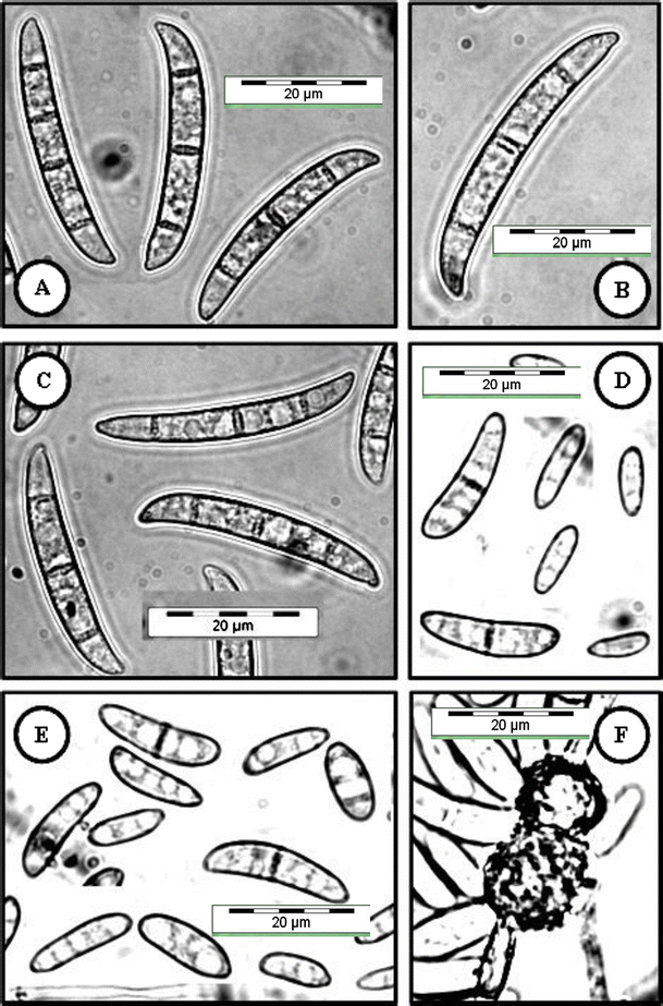 Morphological and Phylogenetic Analysis of Fusarium solani Species ...