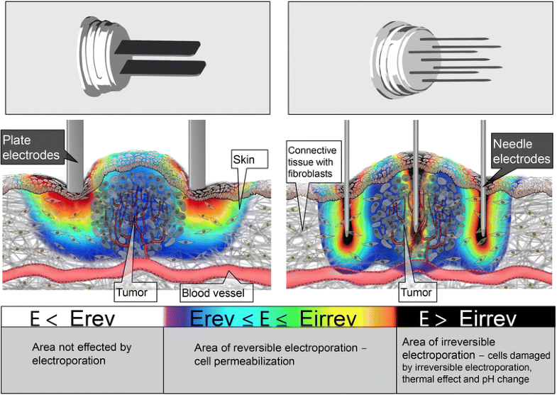 Electrochemotherapy of tumors as in situ vaccination boosted by ...