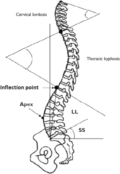 Evidence showing the relationship between sagittal balance and clinical ...