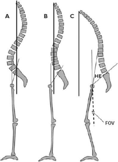Evidence showing the relationship between sagittal balance and clinical ...
