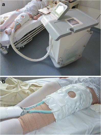 Impact of a new cryotherapy device on early rehabilitation after ...
