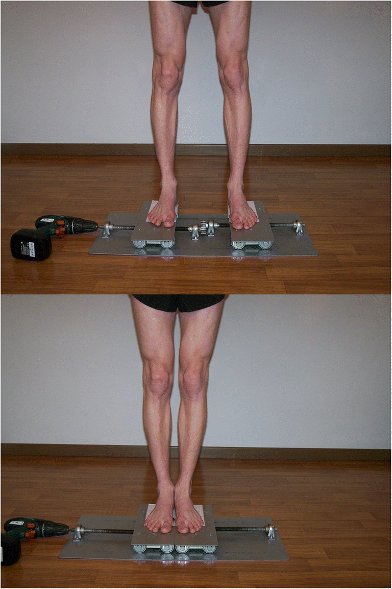 Knee alignment in adolescents is correlated with participation in ...