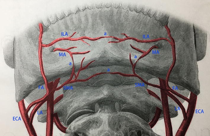 Vascular Complications After Chin Augmentation Using Hyaluronic Acid ...
