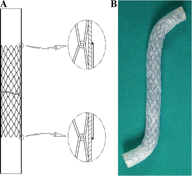 Multicenter Experience of the Newly Designed Covered Metallic Ureteral ...