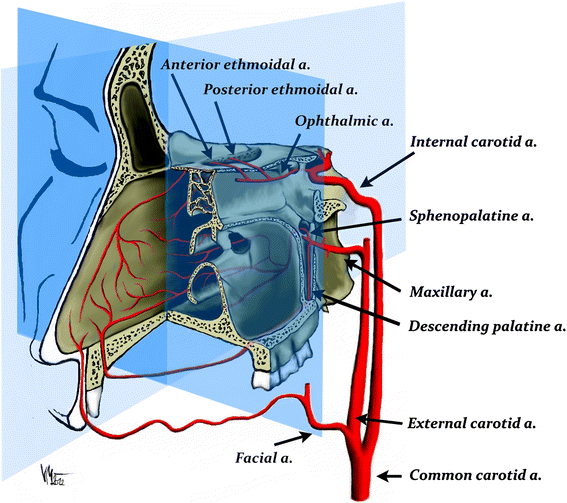 Radiological Diagnosis and Management of Epistaxis | SpringerLink
