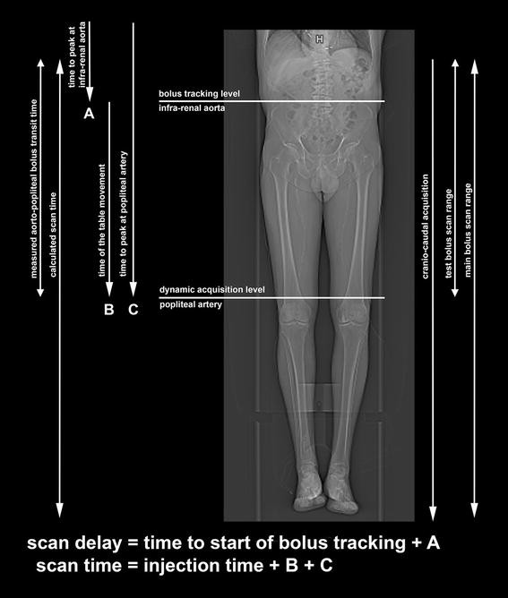 CT Angiography in the Lower Extremity Peripheral Artery Disease ...