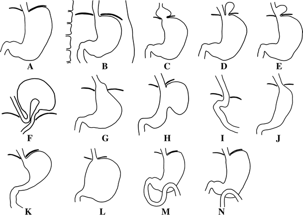 Anatomical classification of the shape and topography of the stomach ...