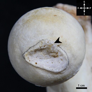 The morphology and morphometry of the fovea capitis femoris | SpringerLink