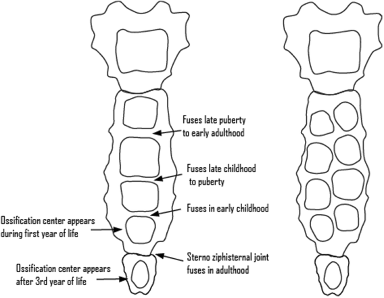 Honeycomb sterna: an unusual case of a developmental abnormality in the ...