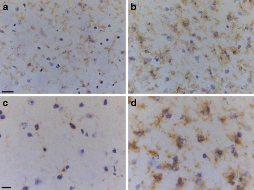 Microglia and macrophages of the central nervous system: the ...