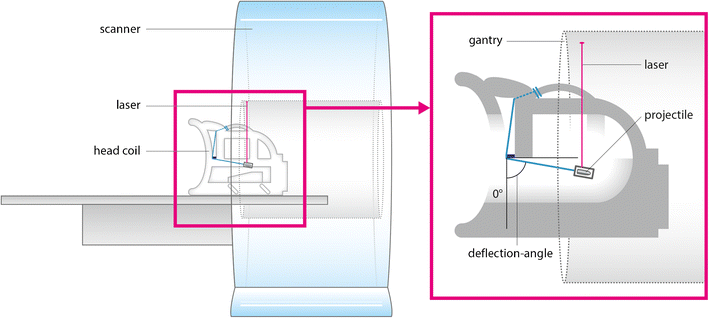 Fairly direct hit! Advances in imaging of shotgun projectiles in MRI ...