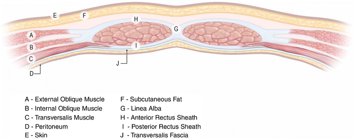 Imaging complex ventral hernias, their surgical repair, and their ...