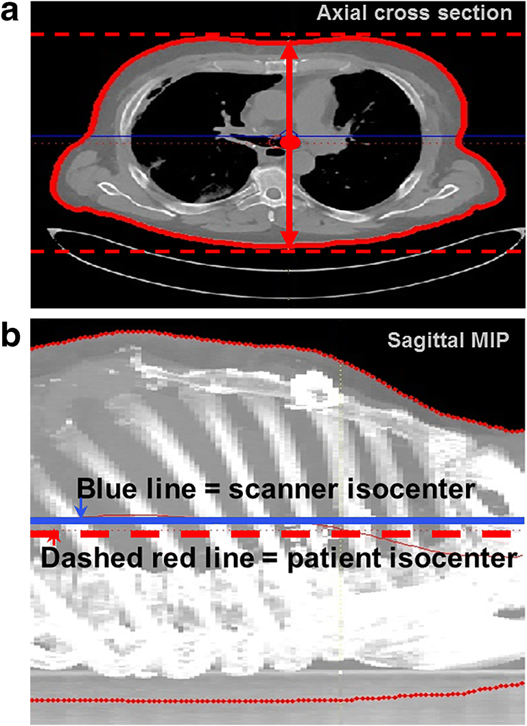 Accuracy of automated patient positioning in CT using a 3D camera for ...