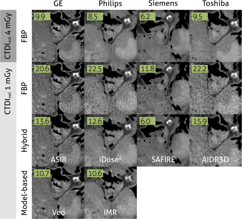 The evolution of image reconstruction for CT—from filtered back ...