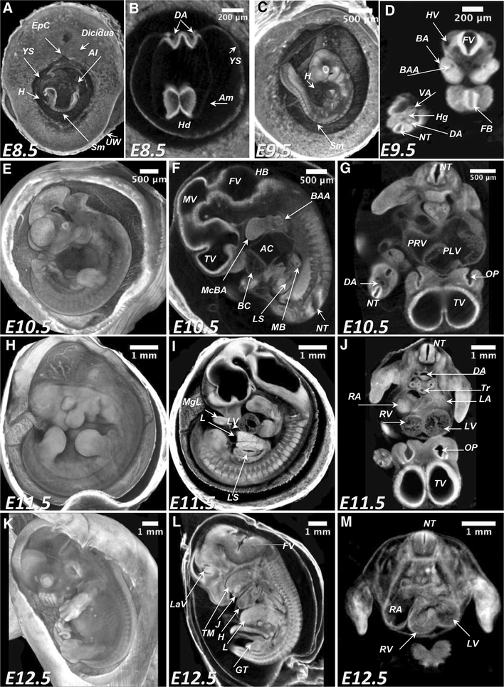 Three-dimensional microCT imaging of murine embryonic development from ...