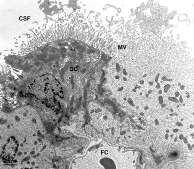 Choroid plexus: biology and pathology | SpringerLink