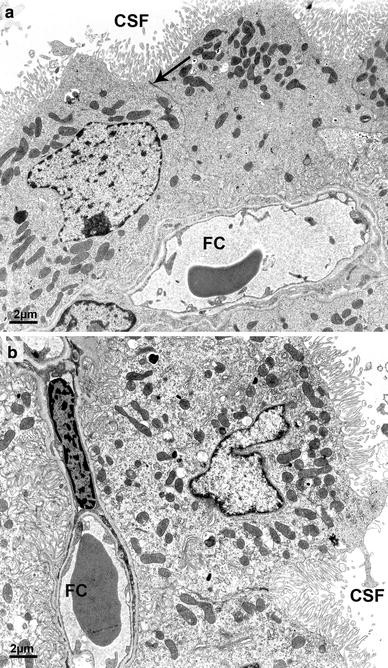 Choroid plexus: biology and pathology | SpringerLink