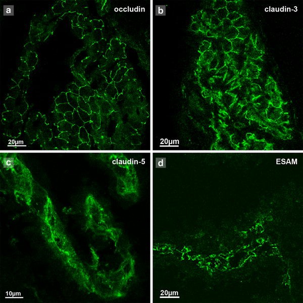 Choroid plexus: biology and pathology | SpringerLink