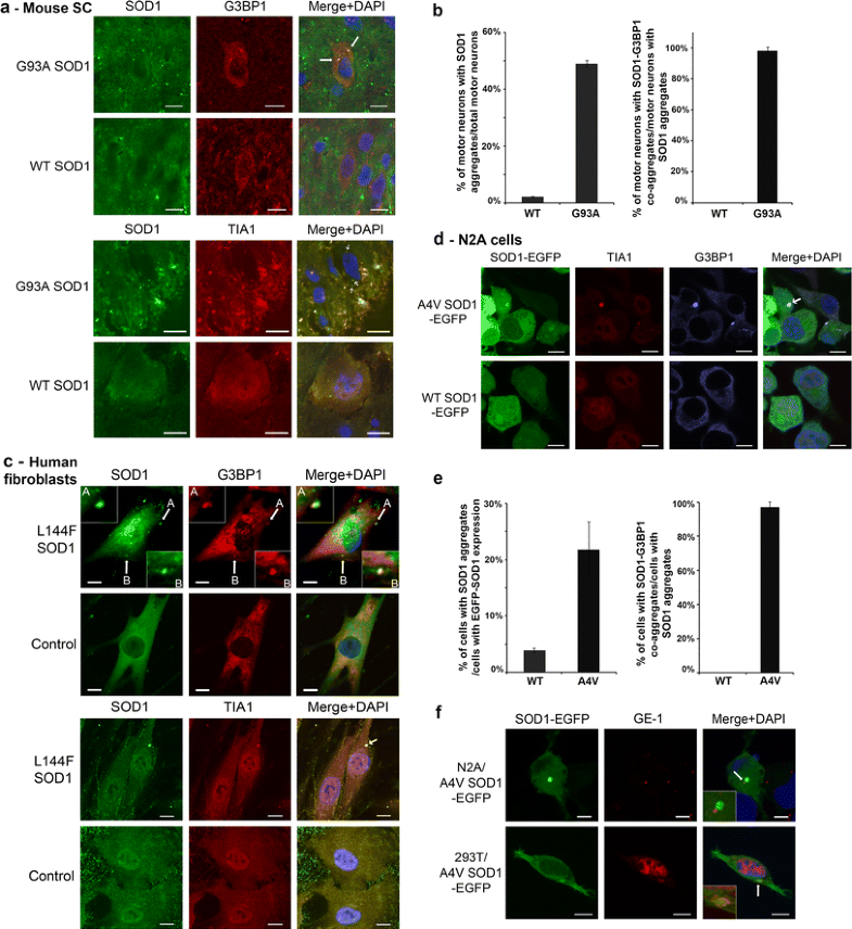 ALS mutant SOD1 interacts with G3BP1 and affects stress granule ...