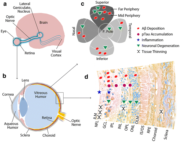 Ocular indicators of Alzheimer’s: exploring disease in the retina ...