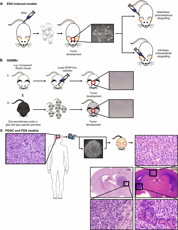 Glioma: experimental models and reality | SpringerLink