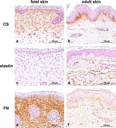 Comparison between human fetal and adult skin | SpringerLink