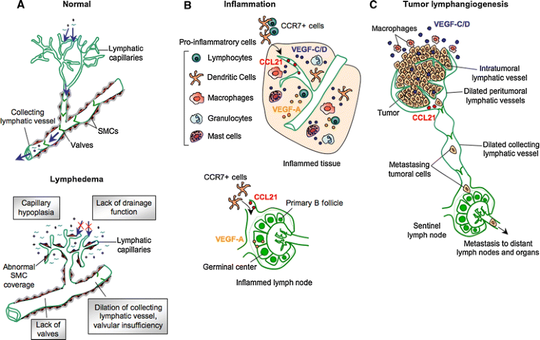 Developmental and pathological lymphangiogenesis: from models to human ...