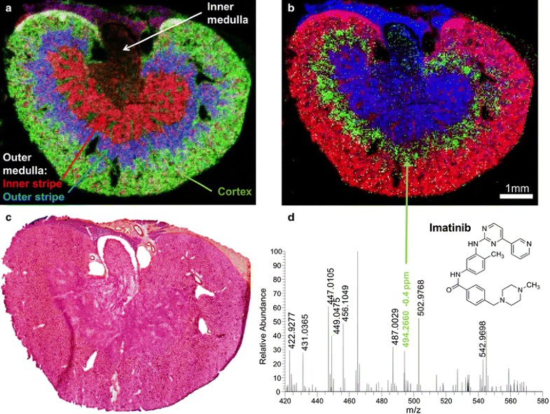 Mass spectrometry imaging with high resolution in mass and space ...