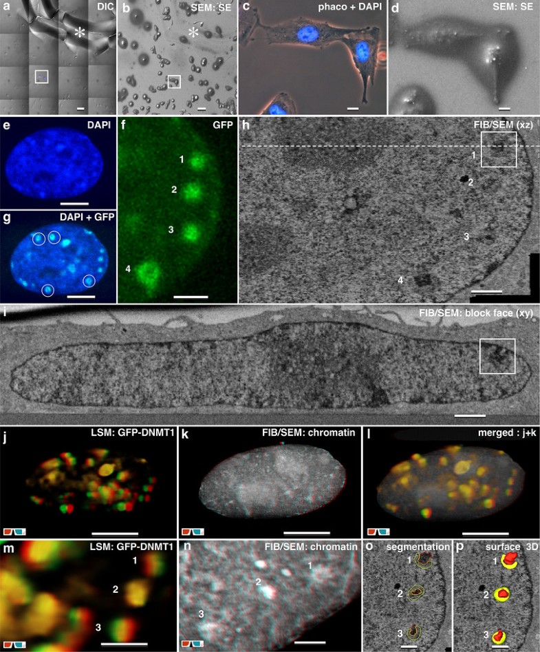 Precise and economic FIB/SEM for CLEM: with 2 nm voxels through mitosis ...