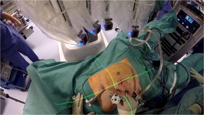 Implementation of robotic rectal surgery training programme: importance ...