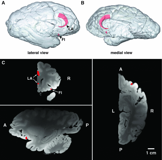 The von Economo neurons in frontoinsular and anterior cingulate cortex ...