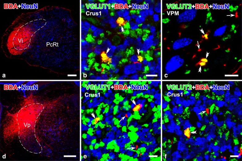 Differential expression of VGLUT1 or VGLUT2 in the trigeminothalamic or ...
