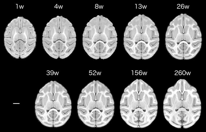Longitudinal analysis of the developing rhesus monkey brain using ...