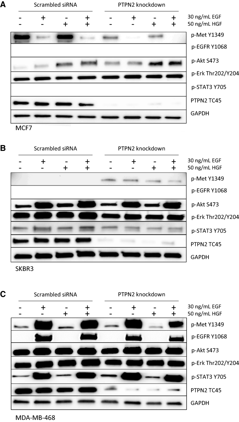 The effects of PTPN2 loss on cell signalling and clinical outcome in ...