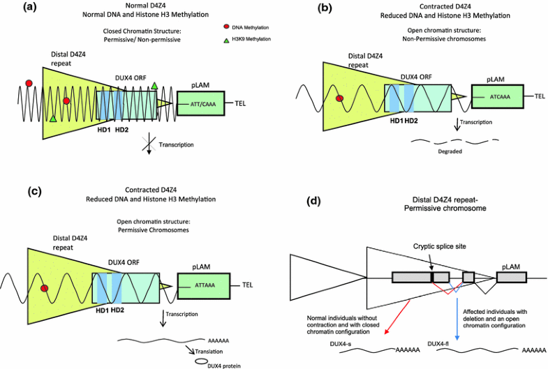 Facioscapulohumeral muscular dystrophy (FSHD): an enigma unravelled ...