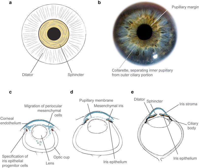 The genetic architecture of aniridia and Gillespie syndrome | SpringerLink