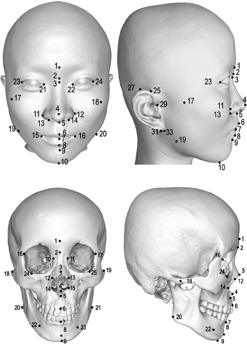 Whole-exome sequencing identified four loci influencing craniofacial ...
