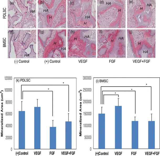 Effects of VEGF and FGF-2 on proliferation and differentiation of human ...