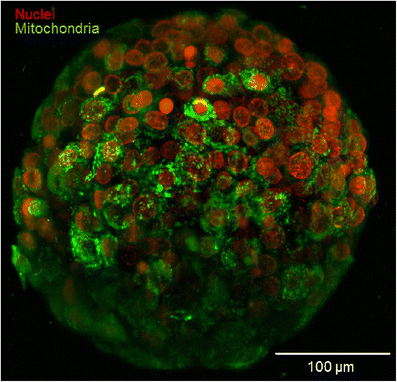 High-resolution deep imaging of live cellular spheroids with light ...