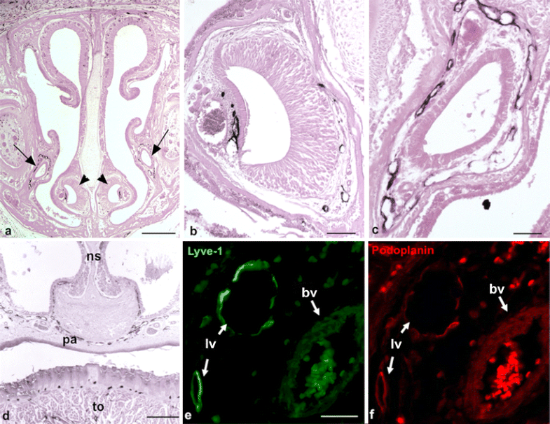 The lymphatic vascular system of the mouse head | SpringerLink