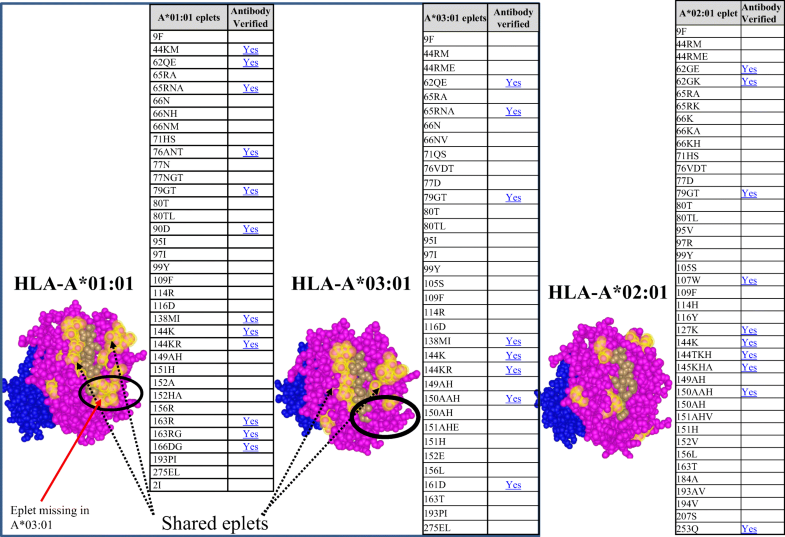 Eplet mismatch analysis and allograft outcome across racially diverse ...
