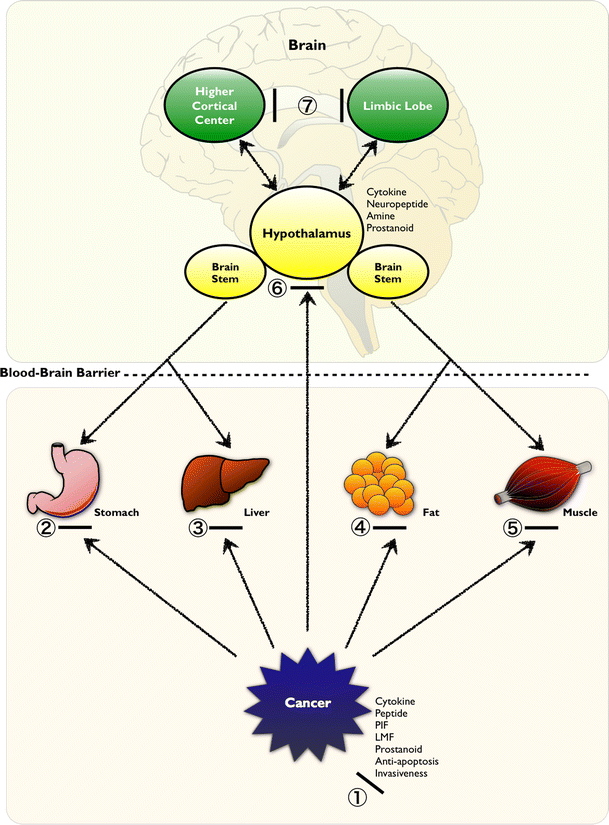 Cancer cachexia—pathophysiology and management | SpringerLink