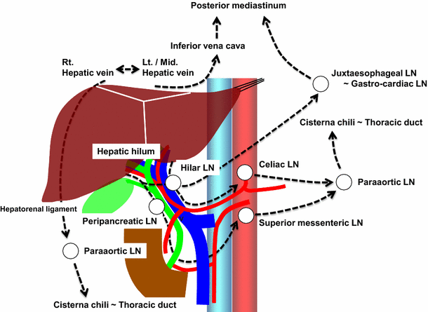 The value of systematic lymph node dissection for intrahepatic cholangiocarcinoma from the ...