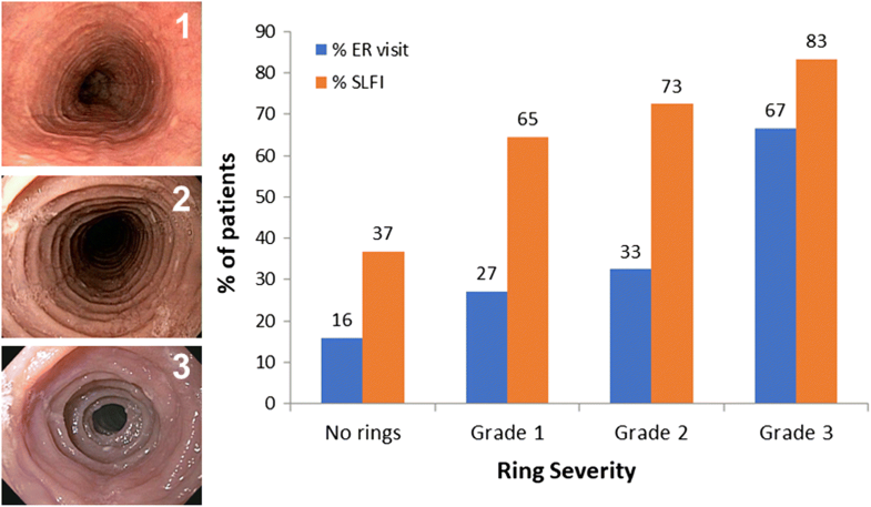 Clinical relevance of esophageal subepithelial activity in eosinophilic ...